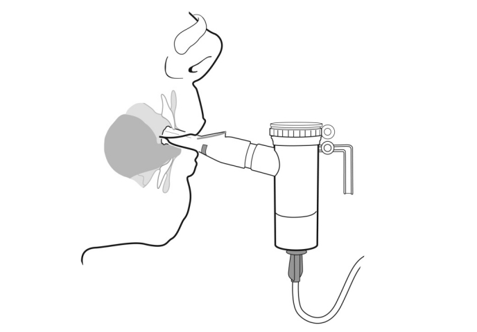 妥布霉素吸入溶液的具体用法及副作用、价格？_医伴旅